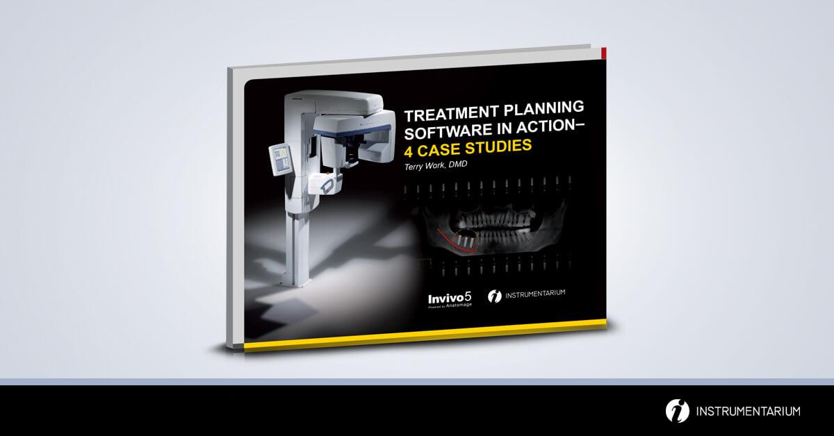 Treatment Planning Software In Action | Instrumentarium